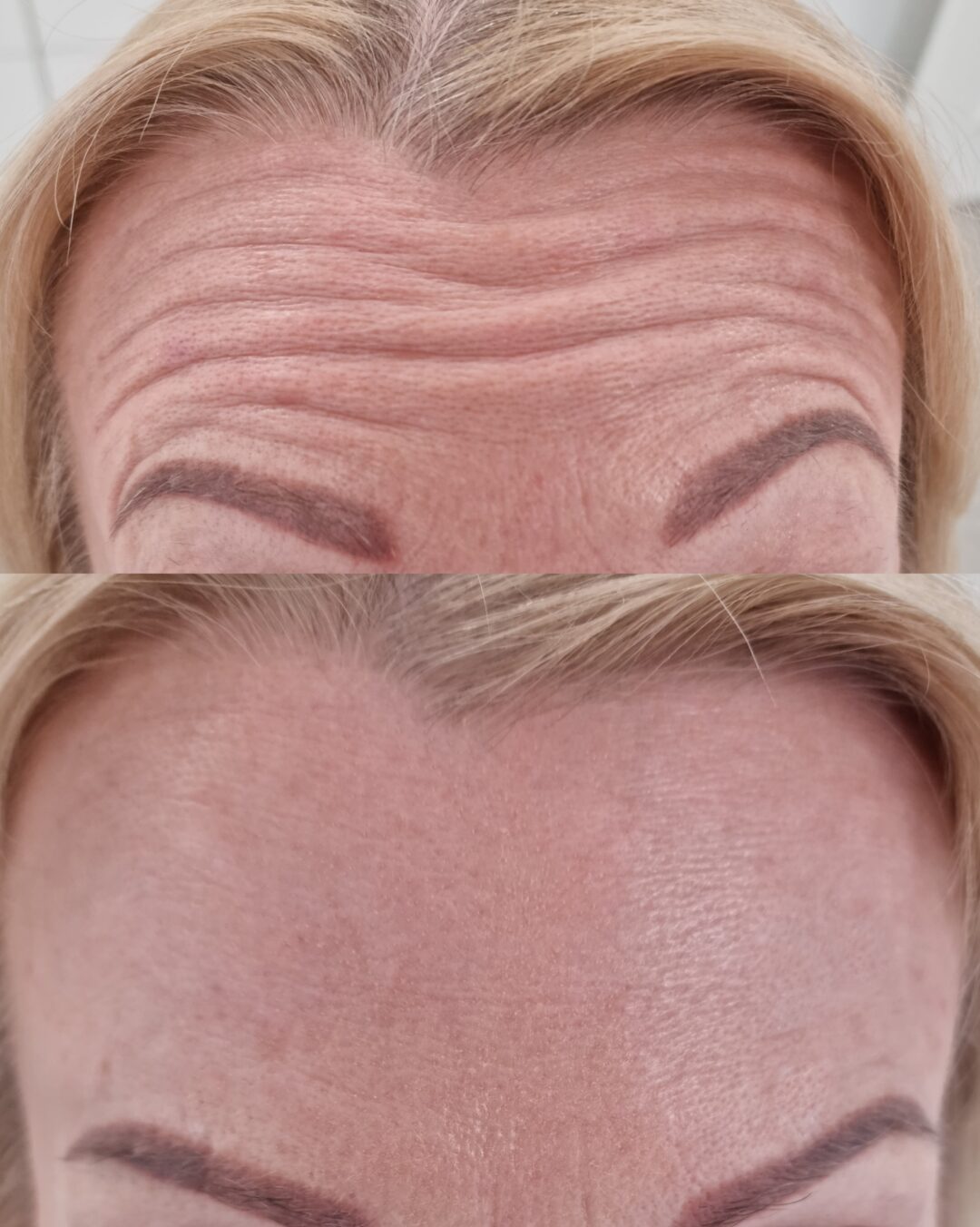 Galeria zdjęć - LipSil dr n. med. Aleksandra Janicka